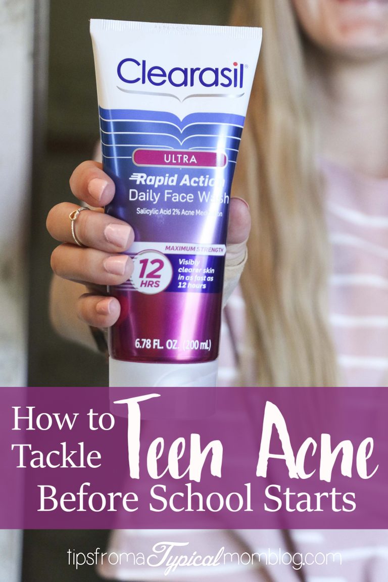 How to Tackle Teen Acne Before School Starts + Clearasil® Sweepstakes ...